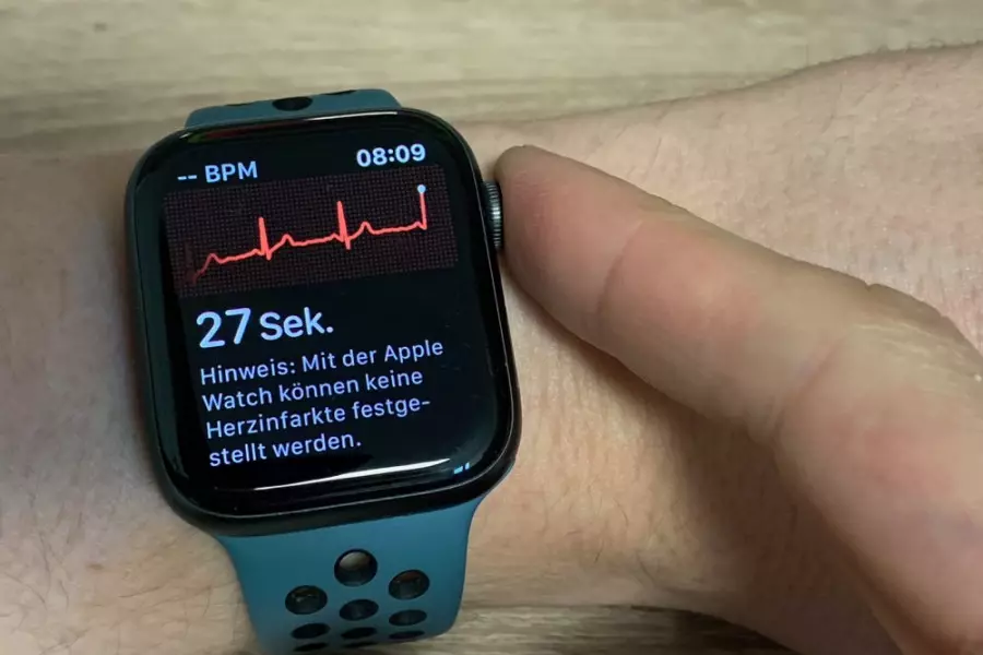 Apple Watch o bontšitse mathata a pelo a sa kang a senola lisebelisoa tsa bongaka